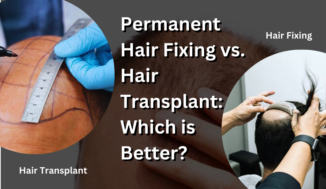 Permanent Hair Fixing: How to Achieve a Full Head of Hair - Hair ...